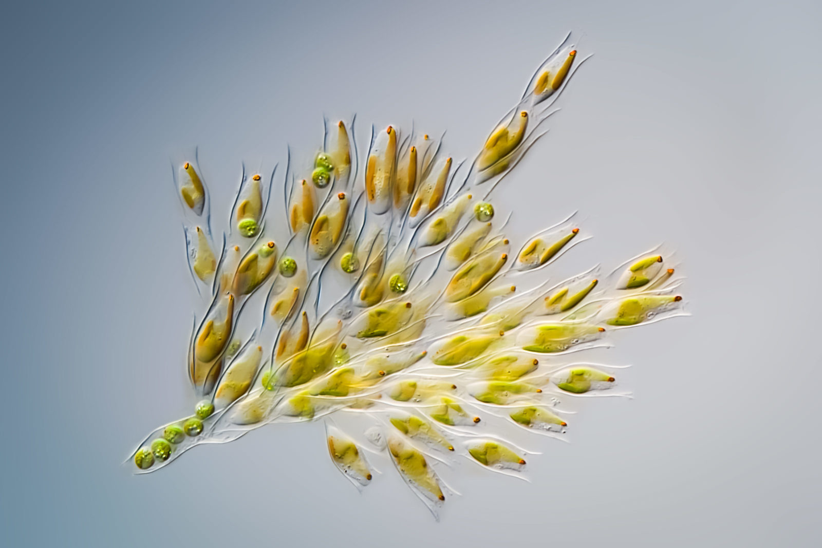 Golden Algae (Prymnesium parvum) | Oklahoma Department of Wildlife ...